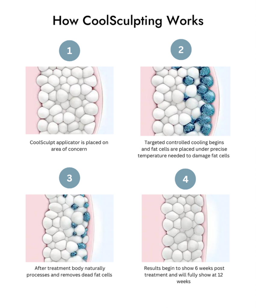 Pros & Cons of Non-Surgical Fat Removal: Heating Vs. Cooling