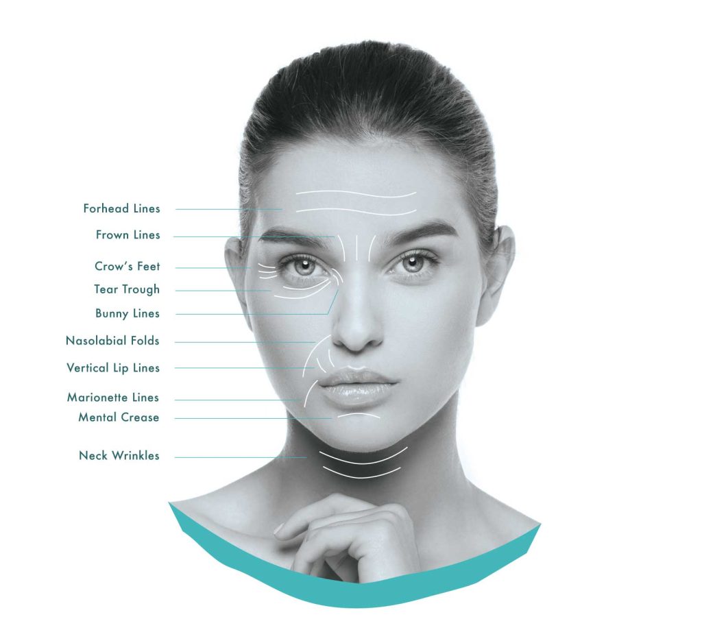 The Complete Guide to Wrinkles | SpaMedica