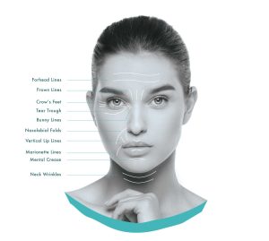 The Complete Guide to Wrinkles | SpaMedica