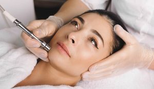 Microdermabrasion vs Microneedling: Essential Differences